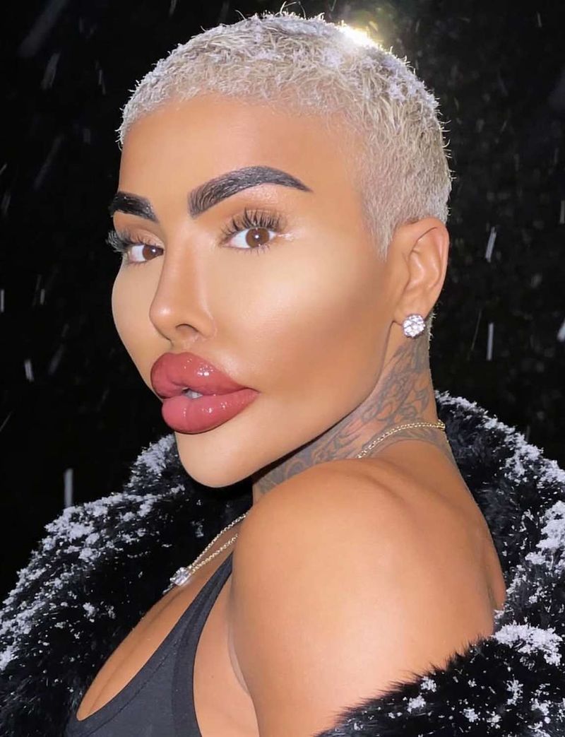 Influencer Populer Dijuluki 'Lip King' Meninggal Dunia setelah Operasi ...
