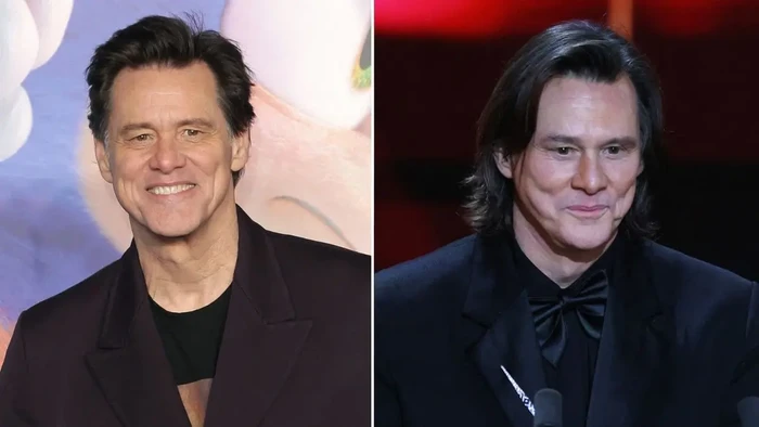 Wajah Nyaris Tak Dikenali, Jim Carrey Diduga Jalani 5 Prosedur Kosmetik Ini