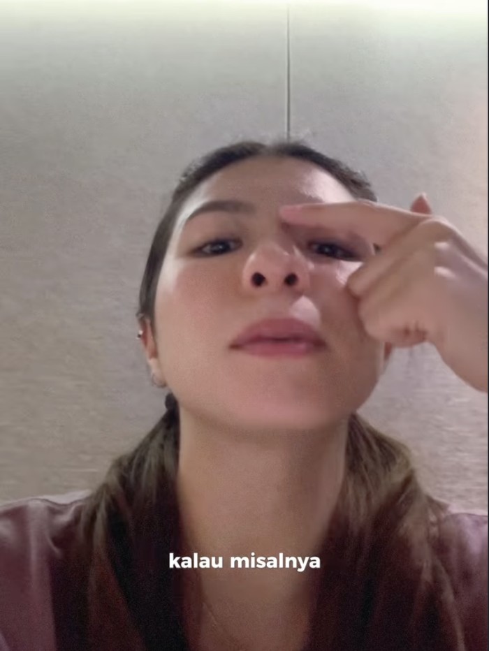 Ini Bagian Wajah Shalom Razade yang Bermasalah Sebelum Dioperasi
