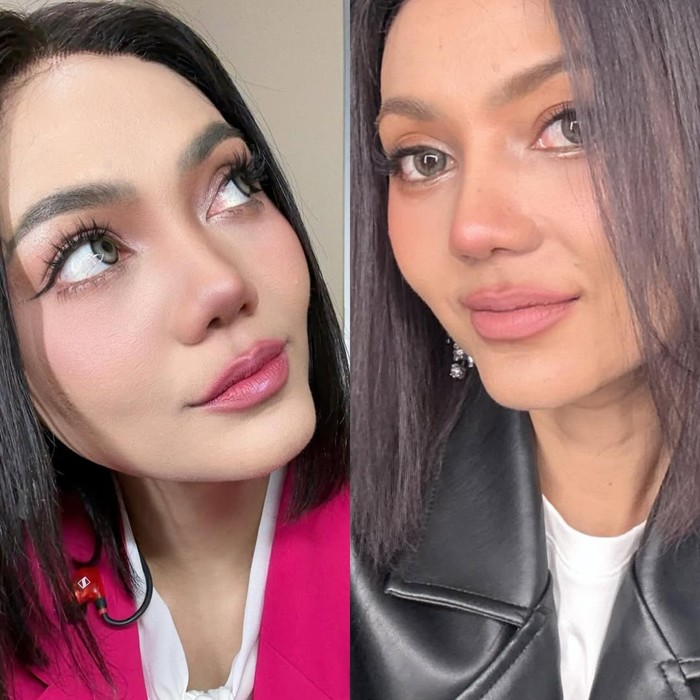 Penampilan Rina Nose Sebelum dan Sesudah Operasi Hidung yang Bikin Pangling