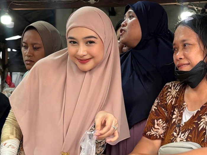 Ria Ricis Ungkap Alasan Operasi Hidung