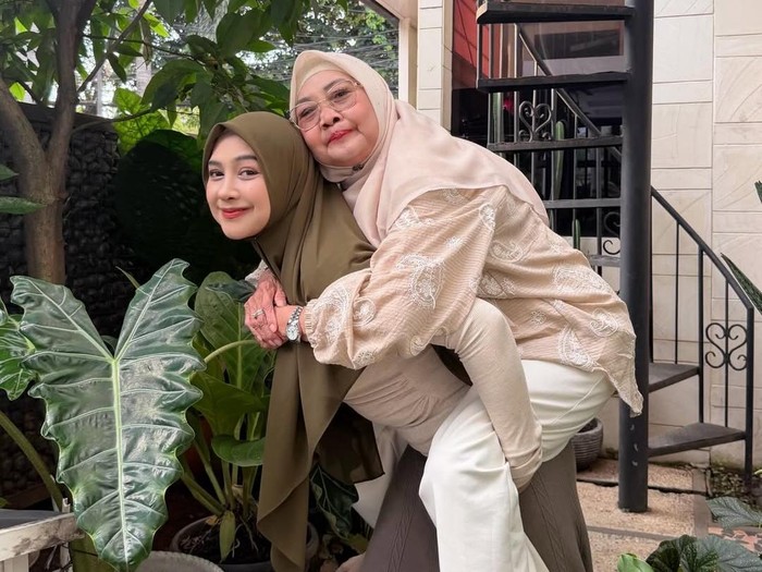 Ria Ricis Ungkap Alasan Operasi Hidung
