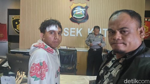 Niat Cari Kerja di Bali, Pria Sumba Malah Disekap-Disiksa 2 Wanita