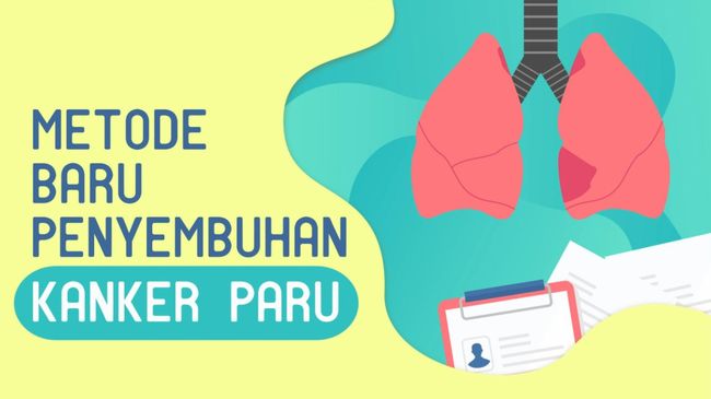 Imunoterapi Terobosan Pengobatan Baru Untuk Penderita Kanker