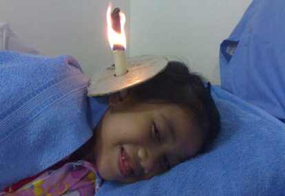 Terapi Lilin Tak Sekedar Buang Tahi Kuping