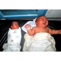 Bayi Raksasa 8,7 Kg Lahir di Sumut, Rekor Baru di Indonesia