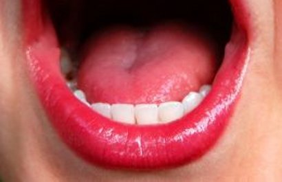 Gangguan Kelenjar Ludah