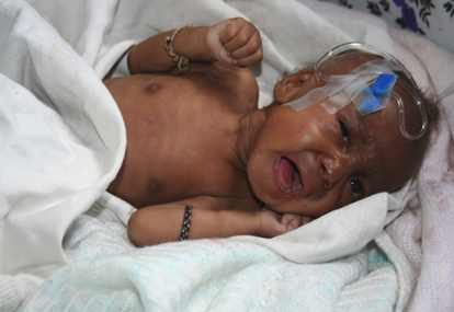 Kasus HIV Anak Indonesia Meningkat 700 Persen