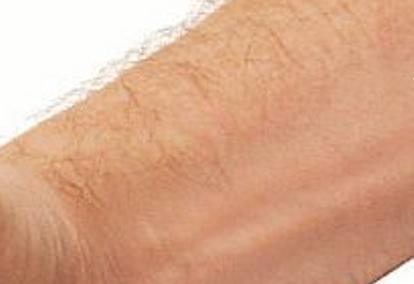 Kenapa Orang Bisa Merasa Merinding?