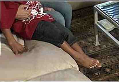 Bibir dan Lidah Bocah Melepuh Setelah Makan Kondom Bekas