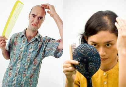 Tanda-tanda Munculnya Kebotakan Pada Pria dan Wanita