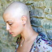 10 Kanker yang Paling Mematikan dan Sulit Disembuhkan