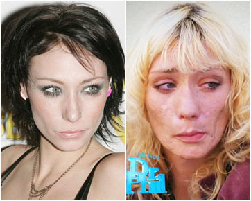 Pasca Ikut America's Next Top Model, Malah Jadi Pecandu Narkoba