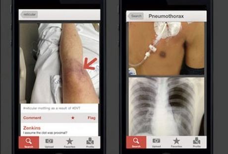 Instagram untuk Dokter, Khusus Berbagi Foto Medis dan Kasus Penyakit