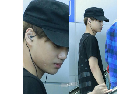 Ada Bercak Putih di Wajah, Bintang K-Pop Ini Panuan?