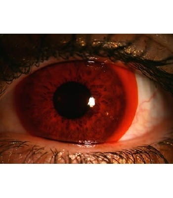 Ini 5 Lensa Kontak Teraneh di Dunia