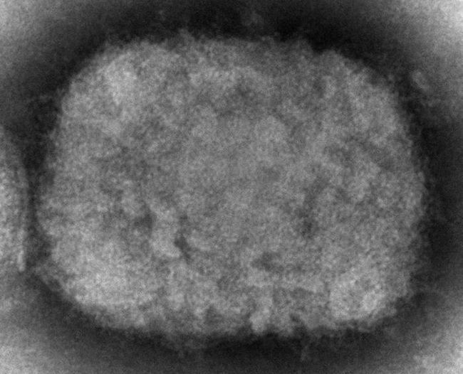 Hati-hati Wabah Monkeypox, Cek Daftar Gejala Cacar Monyet
