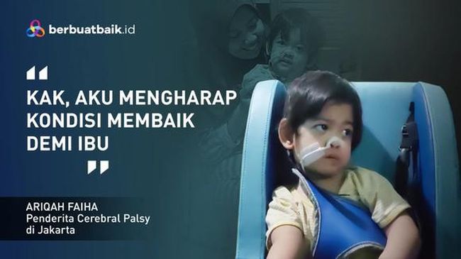 Nasib Pilu Ariqah, Bocah 4 Tahun yang Alami Kelumpuhan Otak