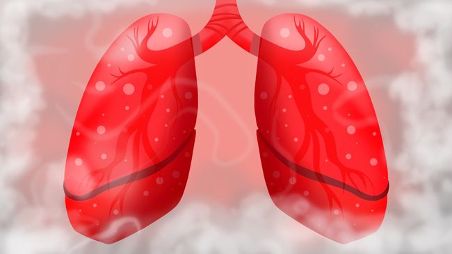 Perokok Wajib Baca, 5 Langkah Membersihkan Paru-Paru