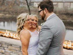 8 Foto Kembar Siam Dempet yang Punya 1 Kelamin, Salah Satunya Punya Pacar